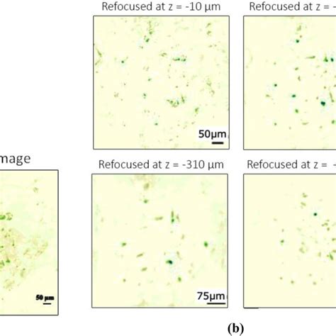 schematic representation of light field microscopy with correlated