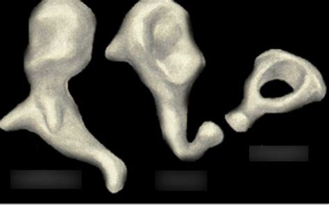 Ossicular Chain Exam 4 Diagram Quizlet