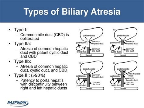 Ppt Biliary Atresia Powerpoint Presentation Free Download Id1199110