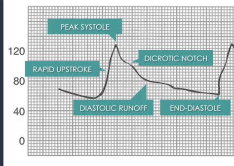 Aacn Ecco 40 Hemodynamic Monitoring Critically Ill Patients Part 1