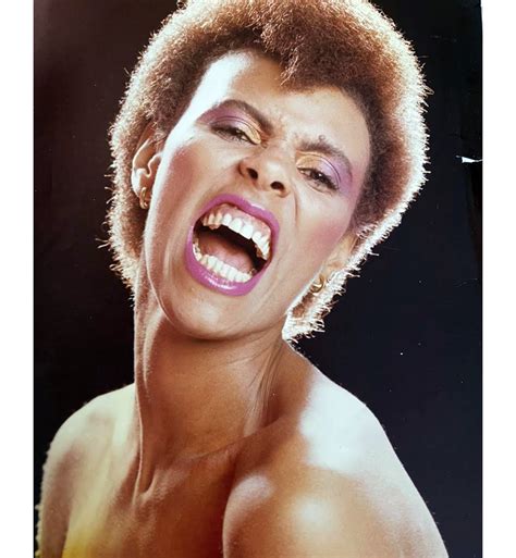 Anamá Ferreira A los años escuchaba a los médicos debatir a qué altura amputarían mi pierna