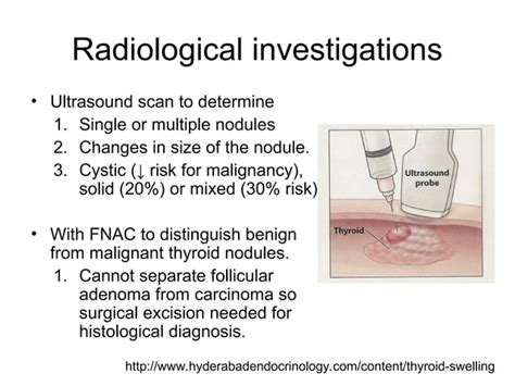 Thyroid Hormones Hyper Hypofunction Ppt