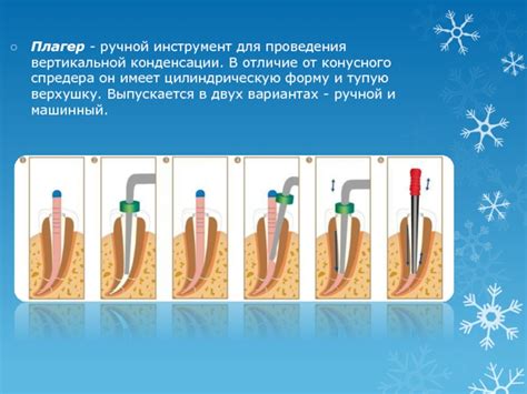 Эндодонтические инструменты
