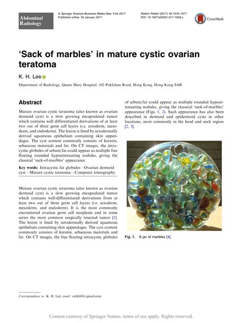 ‘sack Of Marbles In Mature Cystic Ovarian Teratoma