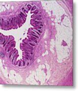 Lm Of A Cross Section Through The Human Appendix Photograph By Jonathan Ashton Science Photo