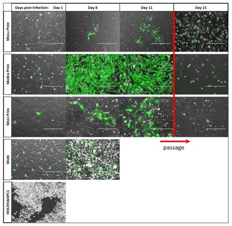 Ebov Gfp Infections Of Different Cells Fluorescence Microscopy Of Cell Download Scientific