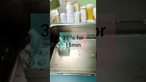 Reticulocyte Count The Blood Test You Didn T Know About Go IT