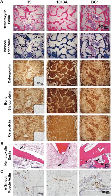 Types Of Bone Tissue Histology