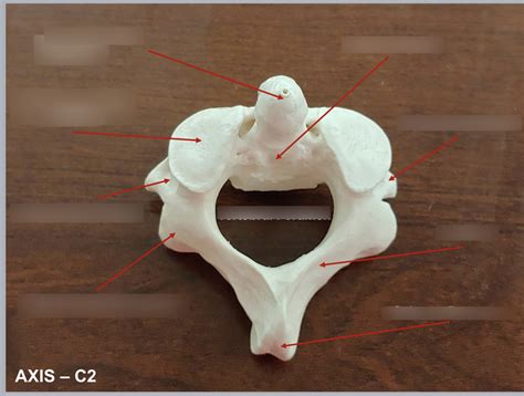 Axis 2 Diagram Quizlet