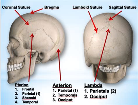 Lambda Skull