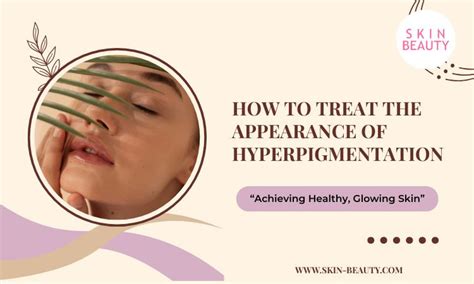 Treatment Of Hyperpigmentation Skin Beauty
