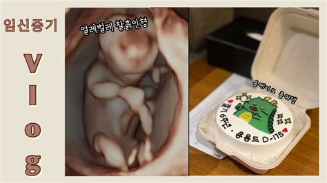 Vlog 115 입덧끝 임신 중기 너무 행복해요임산부브이로그일상사회복지사브이로그워킹맘임신중기입덧해방결혼기념일임당검사입체초음파정밀초음파임신브이로그