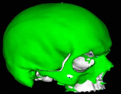 Figure 1 From A Statistical Shape Model Of The Skull Developed From A