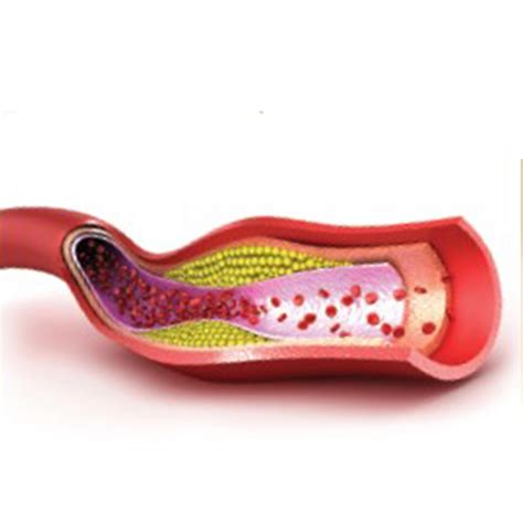 Pentacare Product Details Lashuna Ghanavati