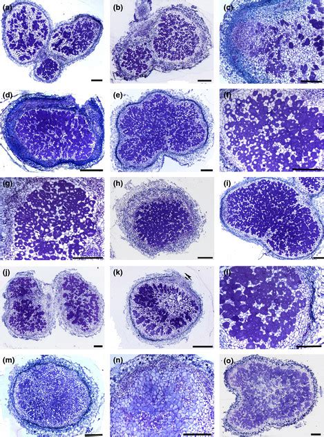 Light Microscopy Of Semi Thin 1 μm Thick Sections Of Mexican Mimosa Download Scientific