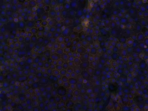 segmentation of cells image analysis image sc forum