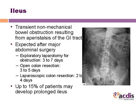 Surgical Complications In The General Surgery Bariatric Surgery