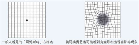 amsler charts 01 視力中心香港有限公司