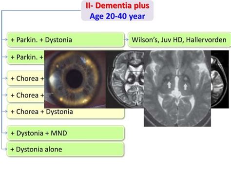 Algorithm For Dementia For Postgraduates Ppt