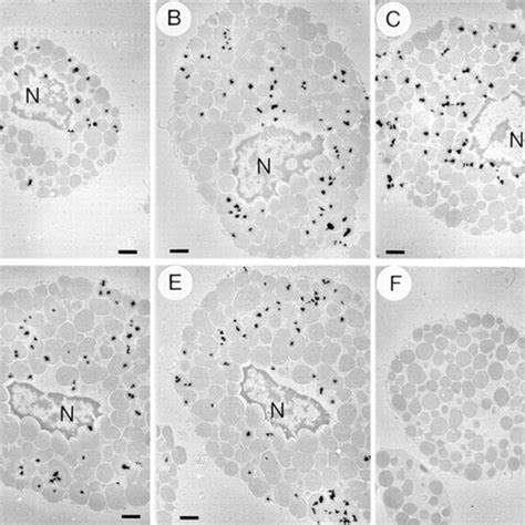 Intracellular Location Of Translocated ¹²⁵i All D Sp In Mast Cells