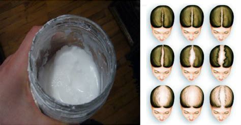 Baking Soda Shampoo Recipe That Will Save Your Hair Health And Love Page