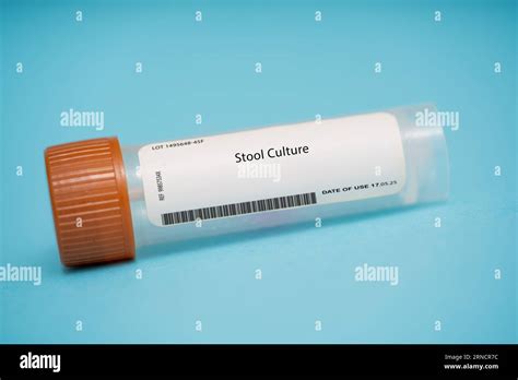 Stool Culture This Test Is Used To Identify The Presence Of Bacteria Viruses Or Parasites In