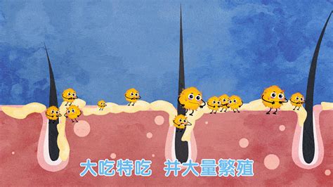 【真相】年纪轻轻竟然英年早秃了！实验告诉你，头发是怎么秃的！ 搜狐大视野 搜狐新闻