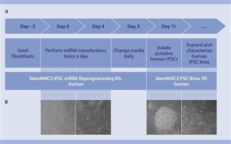reprogramming of human fibroblasts into induced pluripotent stem cells