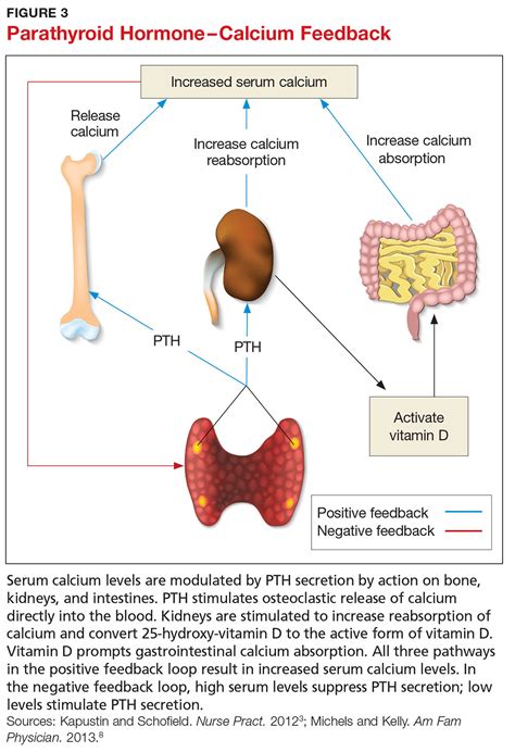 Primary Hyperparathyroidism A Case Based Review Mdedge