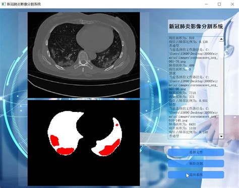 【医学精选】新冠肺炎ct影像病灶分割系统：改进unet csdn博客