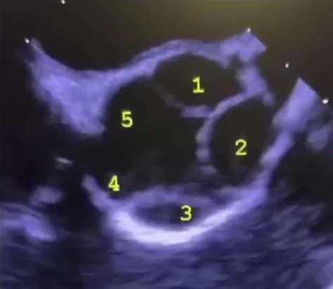 Chishala Chishala Posted On Linkedin