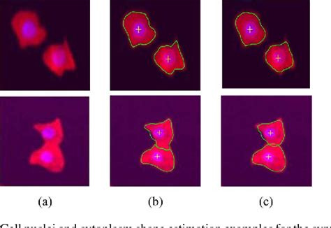 Figure 10 From Cell Nuclei And Cytoplasm Joint Segmentation Using The Sliding Band Filter