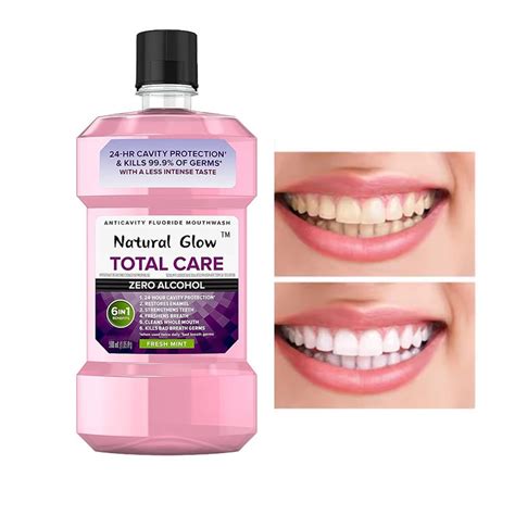 Fluoride Mouthwash Manufacturer 3top