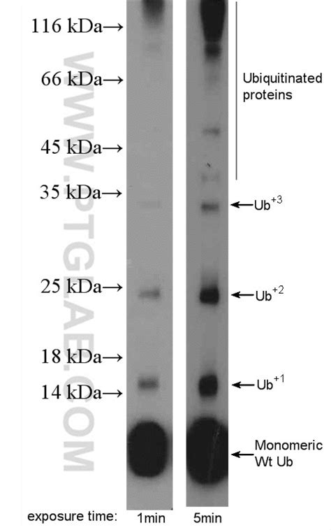Ubiquitin Western Blot