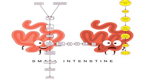 Enterectomy And Enteroanastomosis