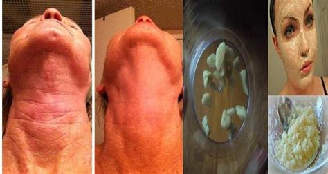 ეს ზღაპრული რეცეპტი მოგაშორებთ ნაოჭებს 7 დღეში სასარგებლო რჩევები