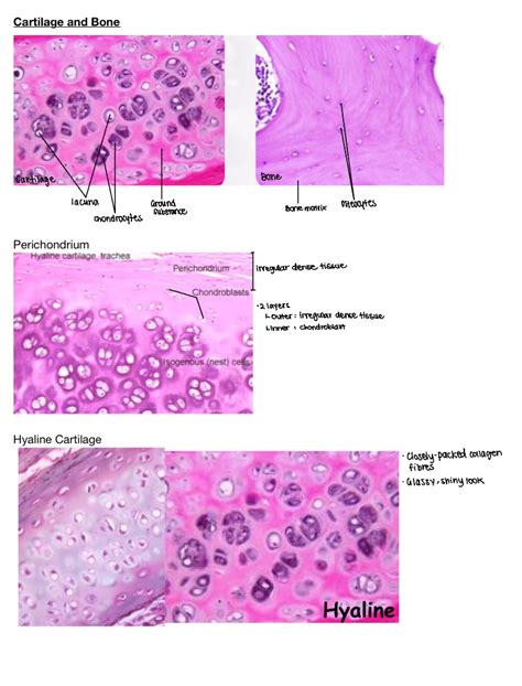 Elastic Cartilage Tissue Under The Microscope Preview Histology Kenhub