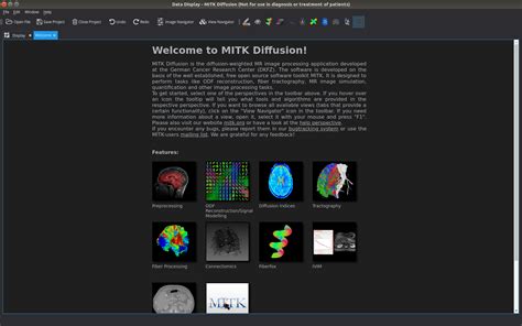 Github Mic Dkfz Mitk Diffusion Mitk Diffusion Official Part Of The