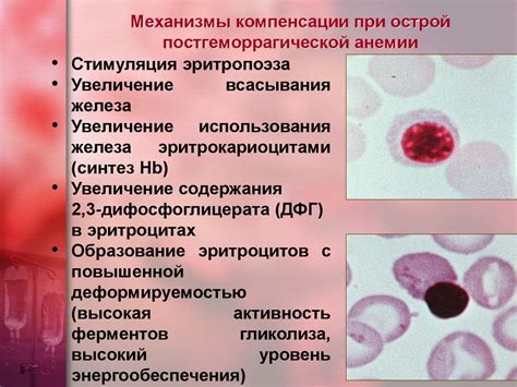 Анемии презентация онлайн