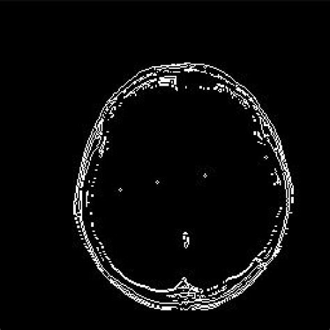 Figure 1 From 2 D Rigid Registration Of Mr Scans Using The 1 D Binary Projections Semantic Scholar