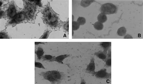 A Eaec 042 Strain Showing Aggregative Adherence On Hela Cells B Download Scientific