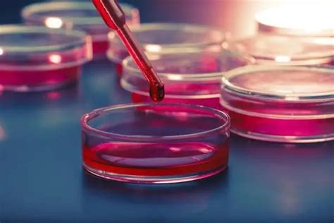 Decreased Bilirubin Possible Causes And Consequences Health