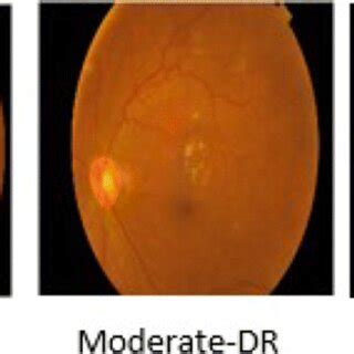 Sample Data Set After Preprocessing Download Scientific Diagram