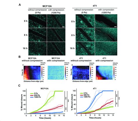 Compressive Stress Inhibits Migration In Mcf10a Cells And Enhances Download Scientific Diagram
