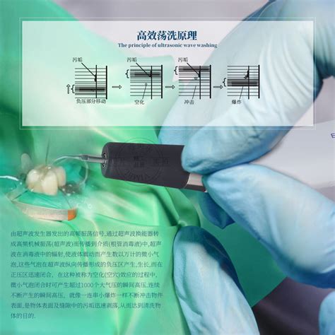 牙科超声波根管荡洗器无线荡洗笔机扩马达牙周机清洗针根管荡洗笔 阿里巴巴