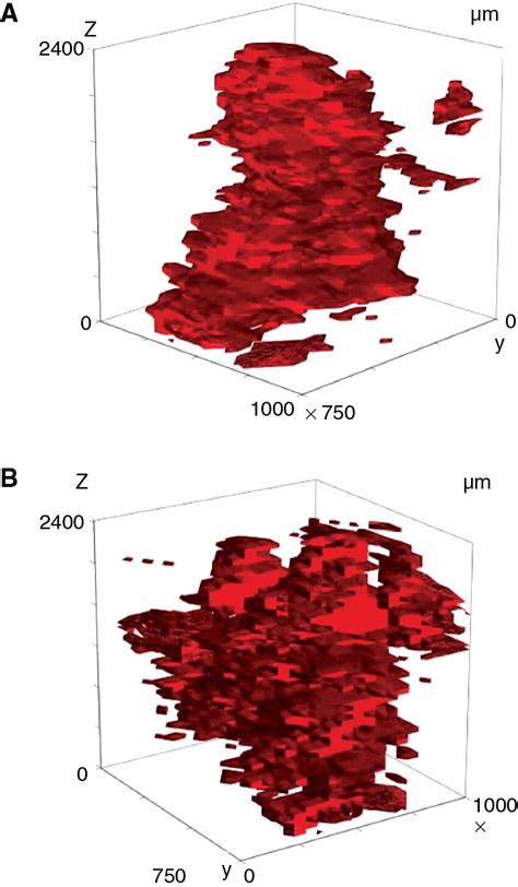 3d Reconstruction Of The Fibrotic Tissue From Segmented Histological Download Scientific