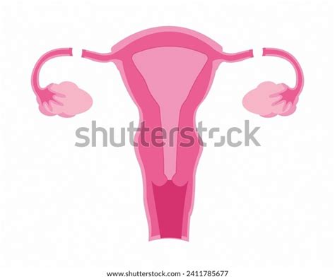 Female Sterilization Procedures Vasectomy Tubal Ligation Stock Vector Royalty Free 2411785677