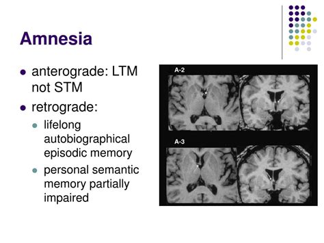 PPT Case Study Amnesia PowerPoint Presentation Free Download ID