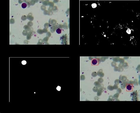Original In A Binary Image In B In C Median Filter For Binary