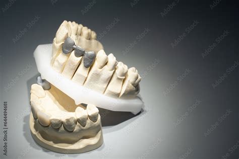 Fotografie Models Of Human Teeth Dental Visual Aid Teeth And Gum Model For Orthodontist